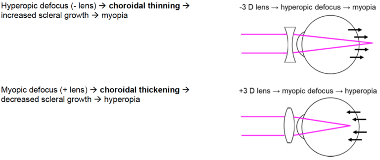 IMI – The Dynamic Choroid: New Insights, Challenges, and Potential ...